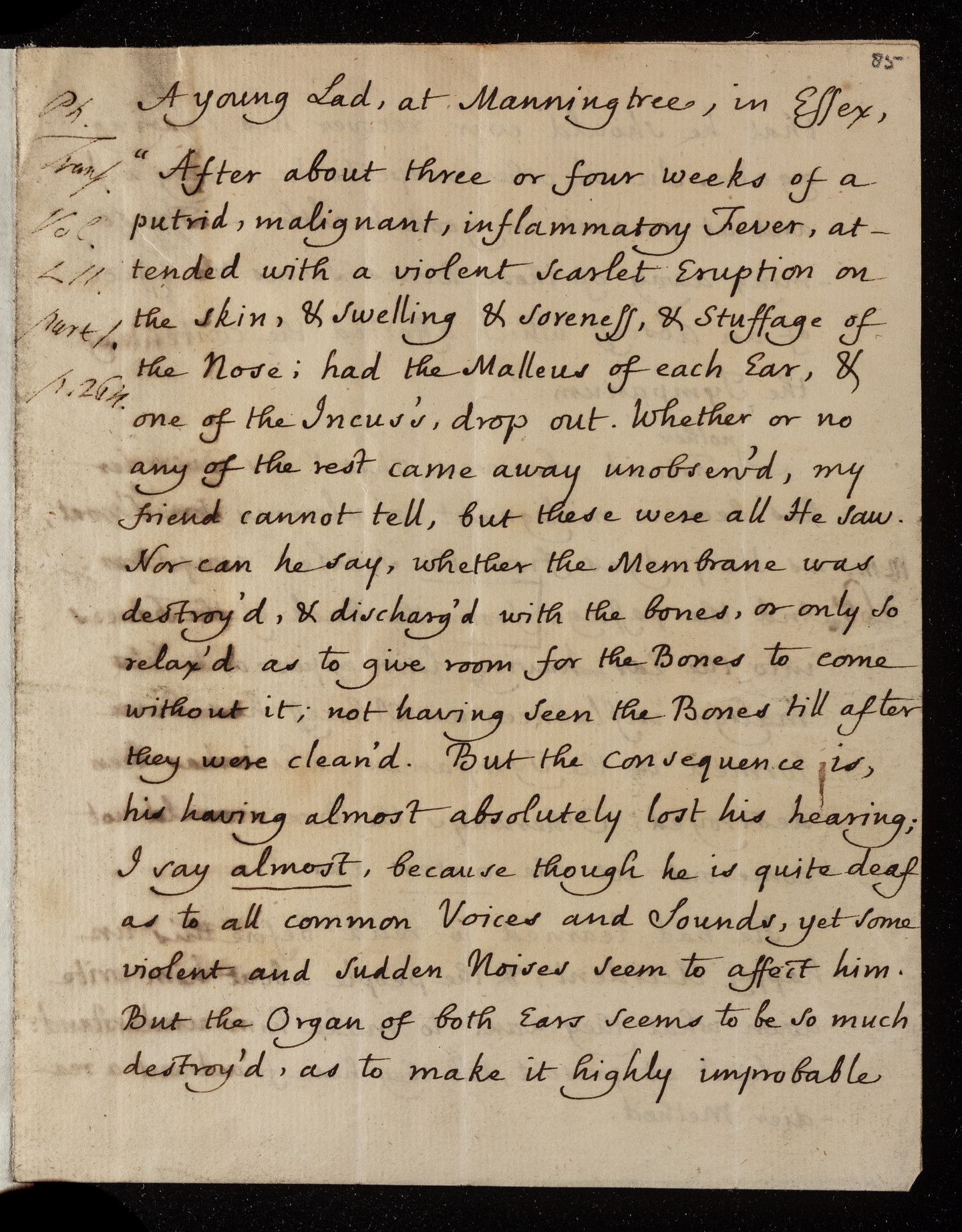 Paper, 'On the loss of Malleus and an Incus after a putrid fever' by ...