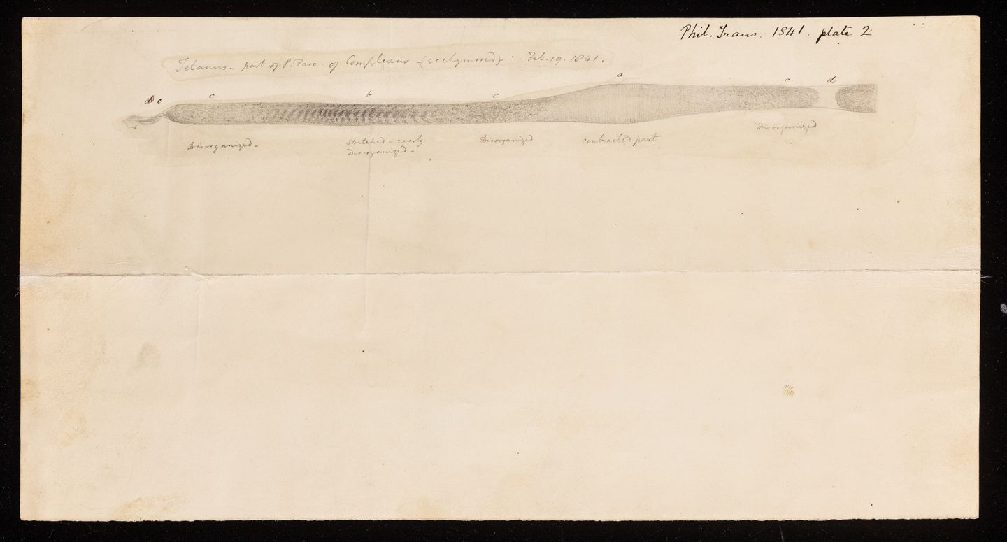 Drawing, 'Tetanus - part of p. fasc. [primitive fasciculi] of complexus ...