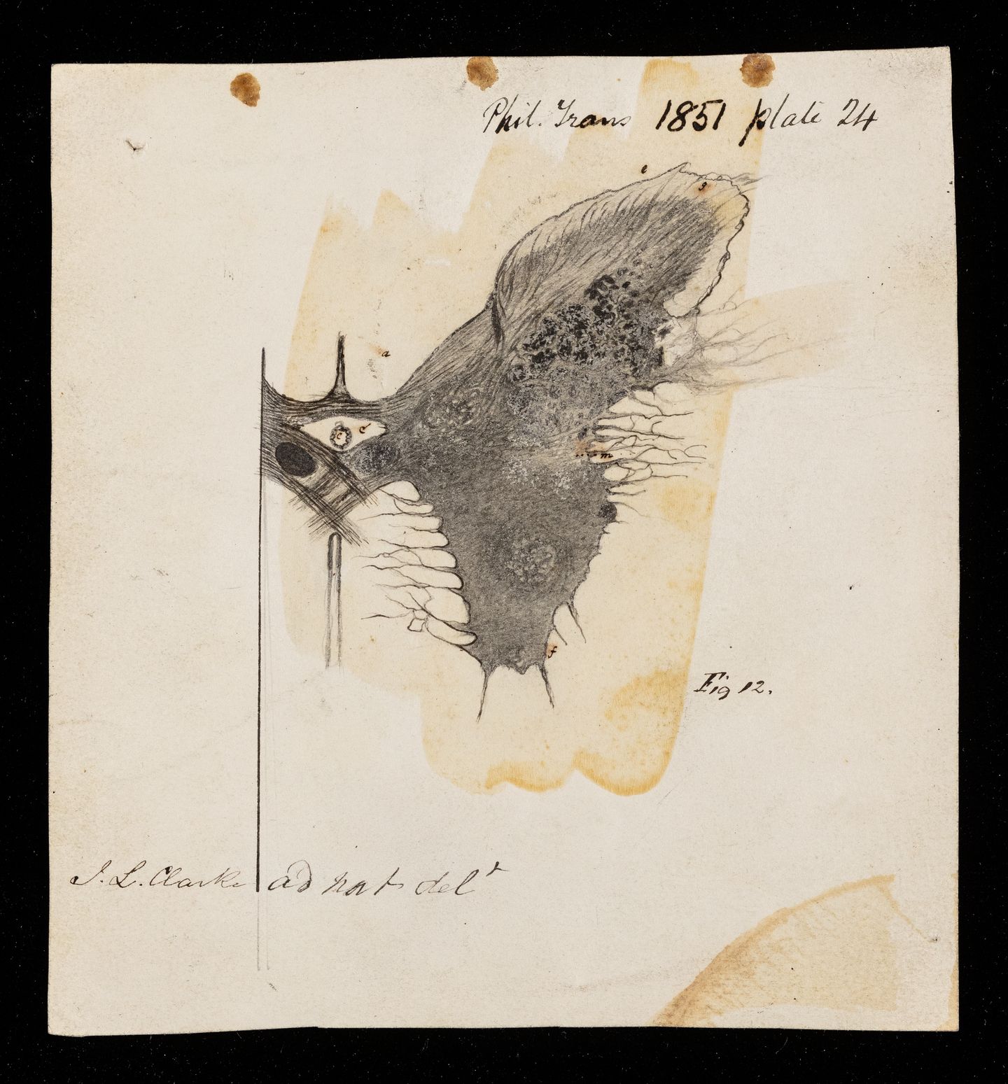 Drawing, grey substance from cervical enlargement of calf spinal chord ...