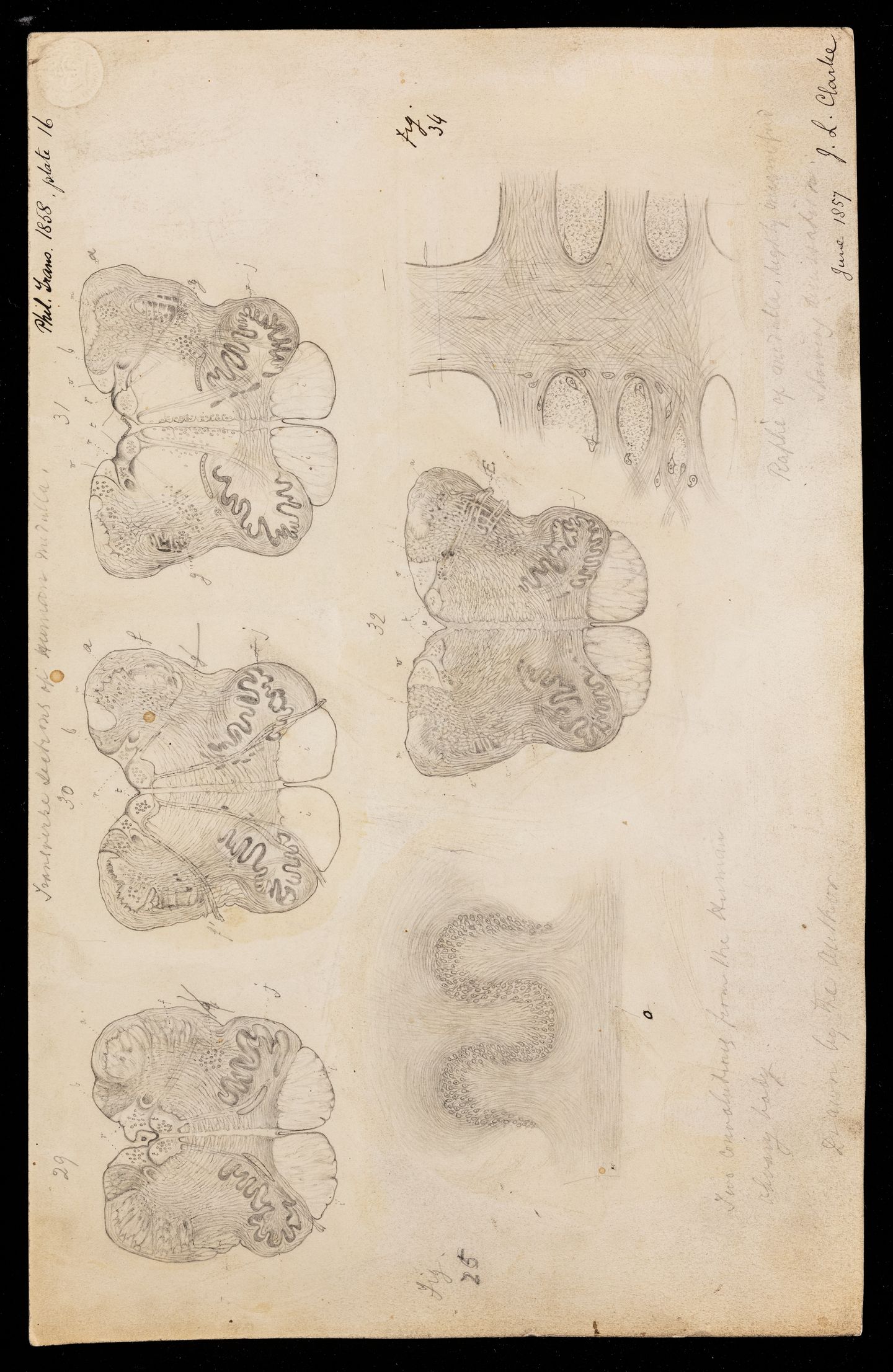 Drawings, 'Transverse sections of human medulla' by J [Jacob Augustus ...